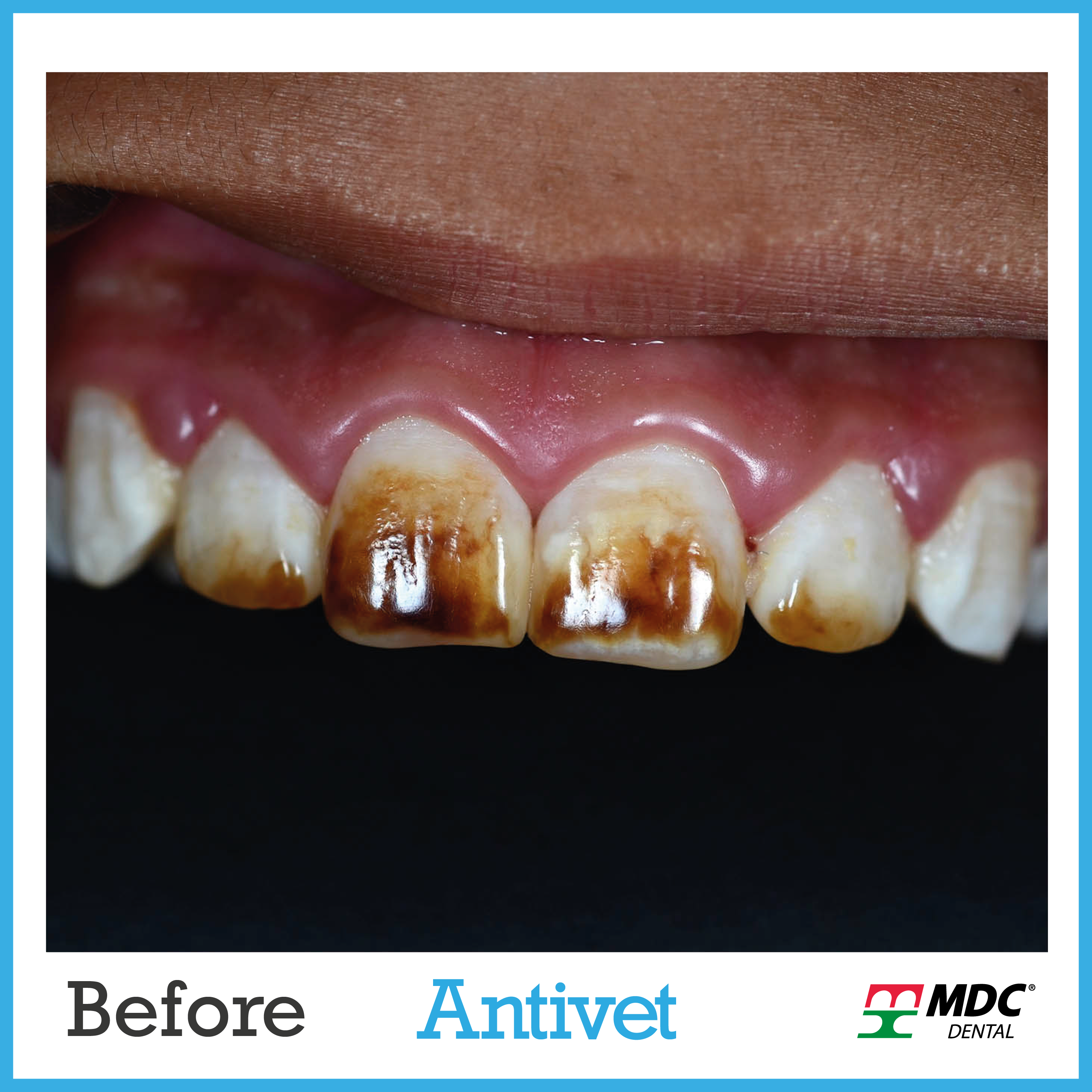 Antivet | Case Studies