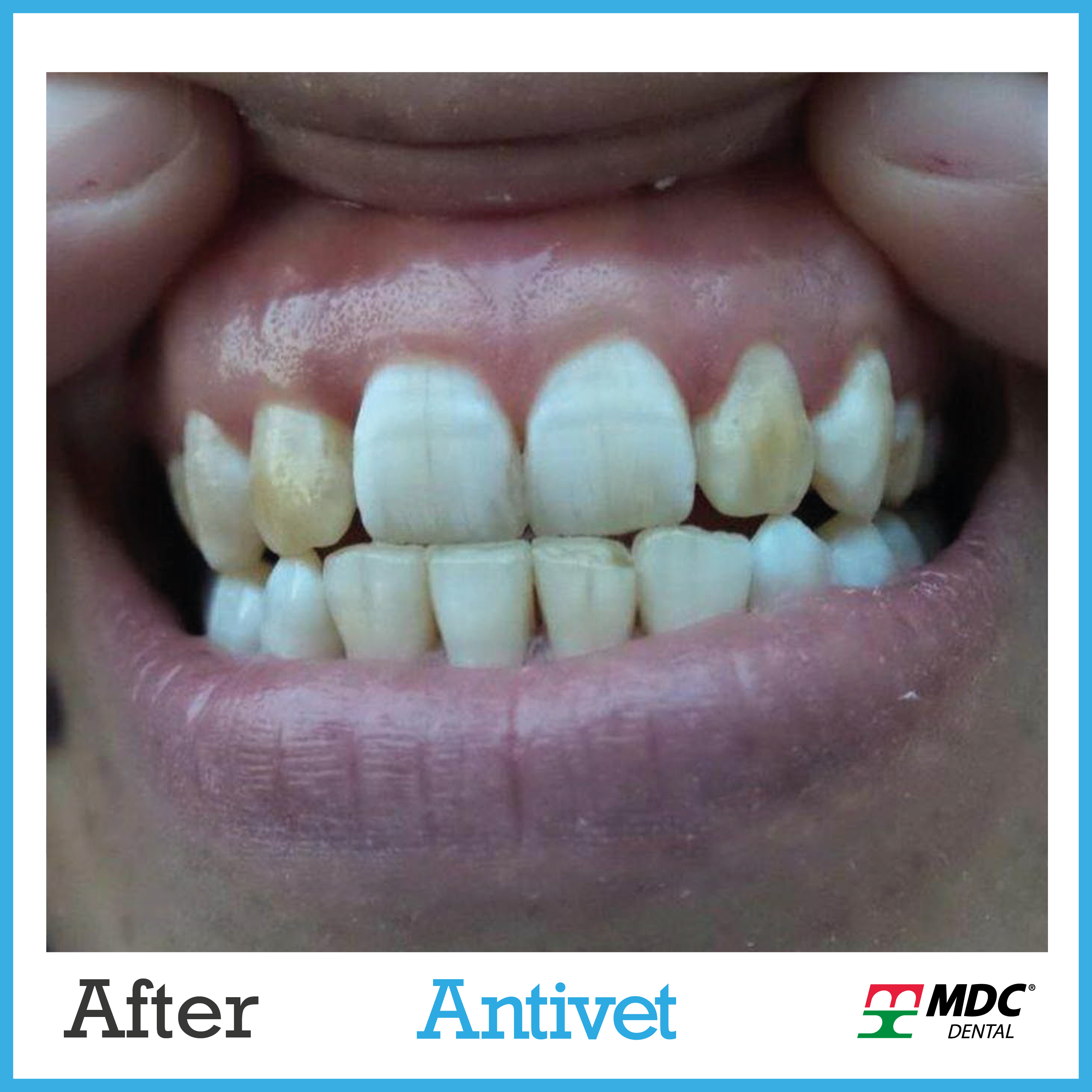 Antivet | Case Studies