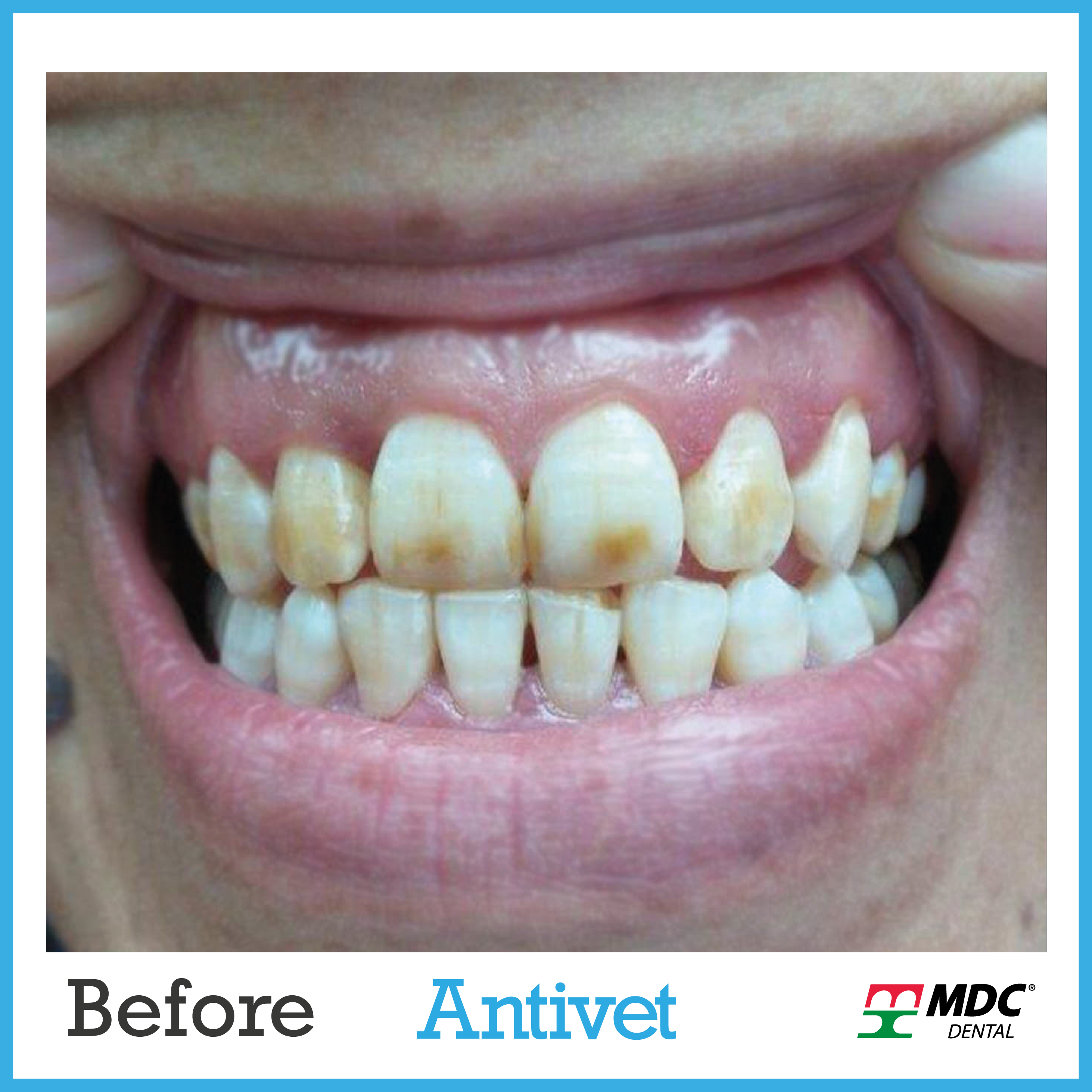 Antivet | Case Studies