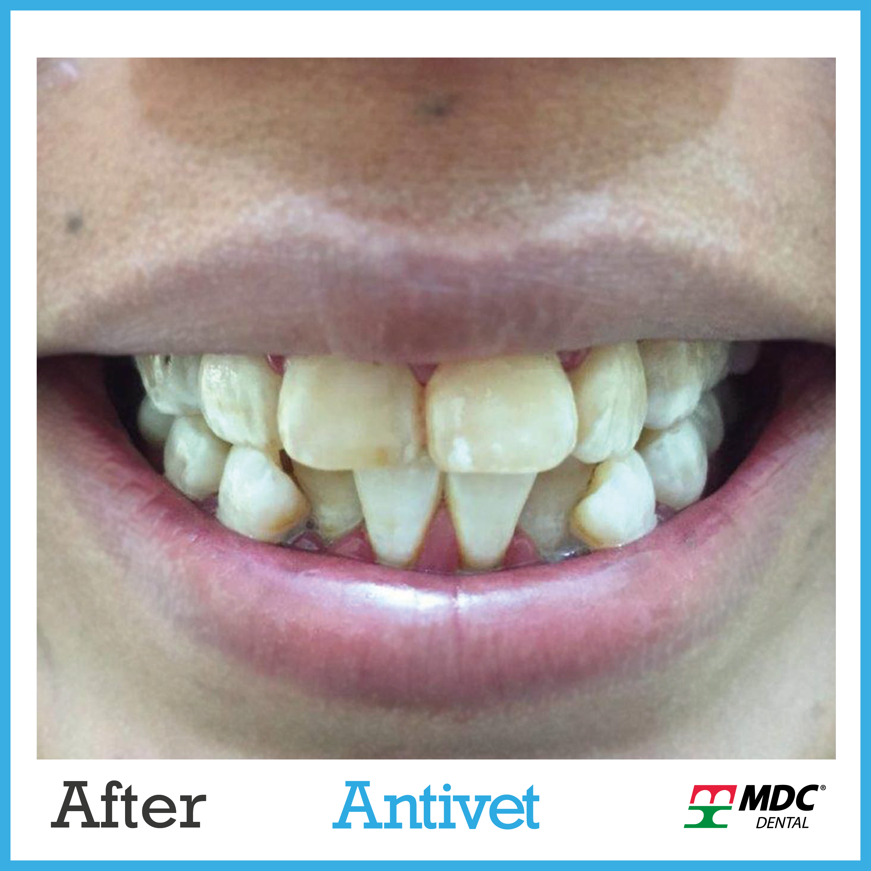 Antivet | Case Studies