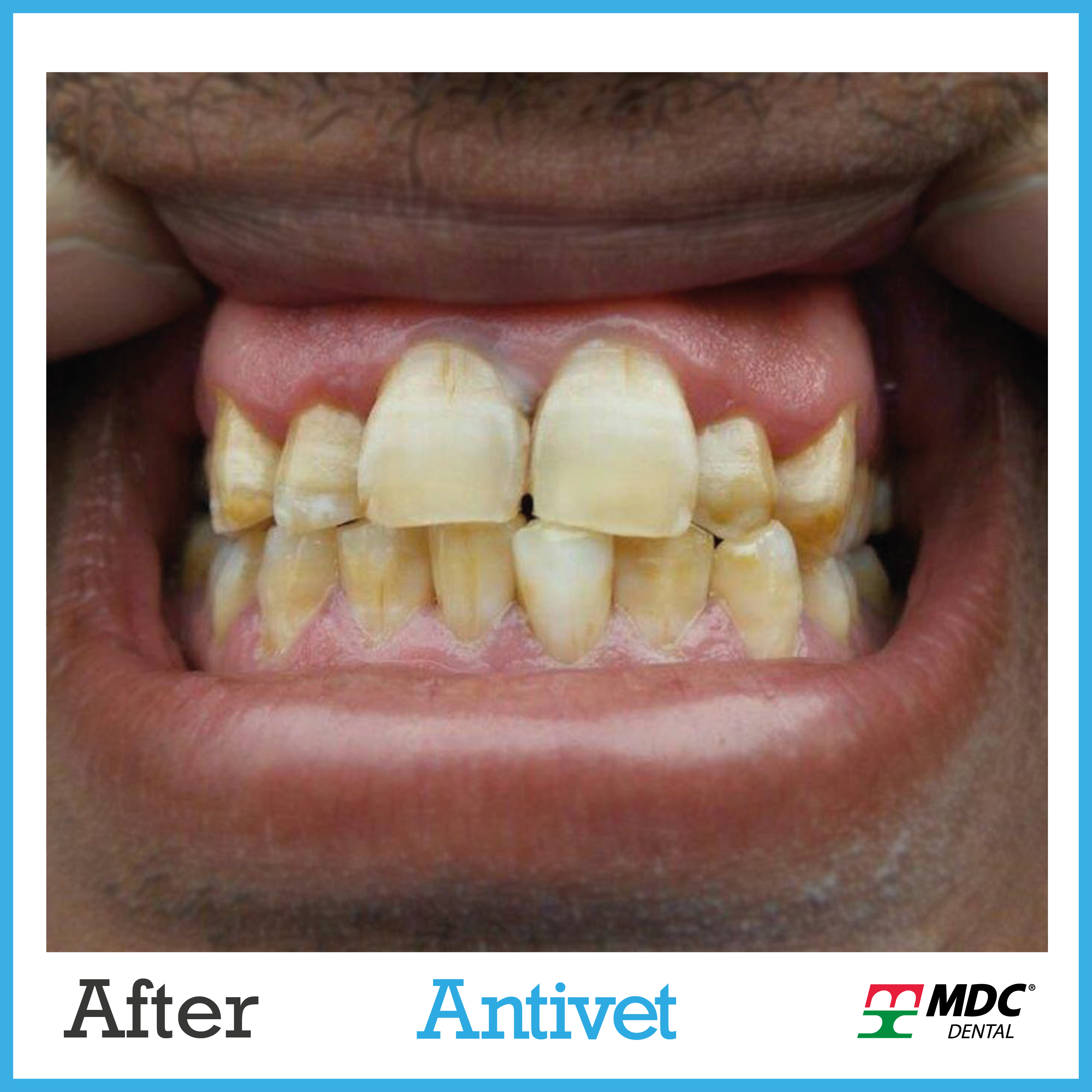 Antivet | Case Studies