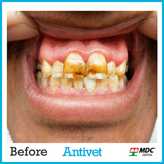 Antivet | Case Studies