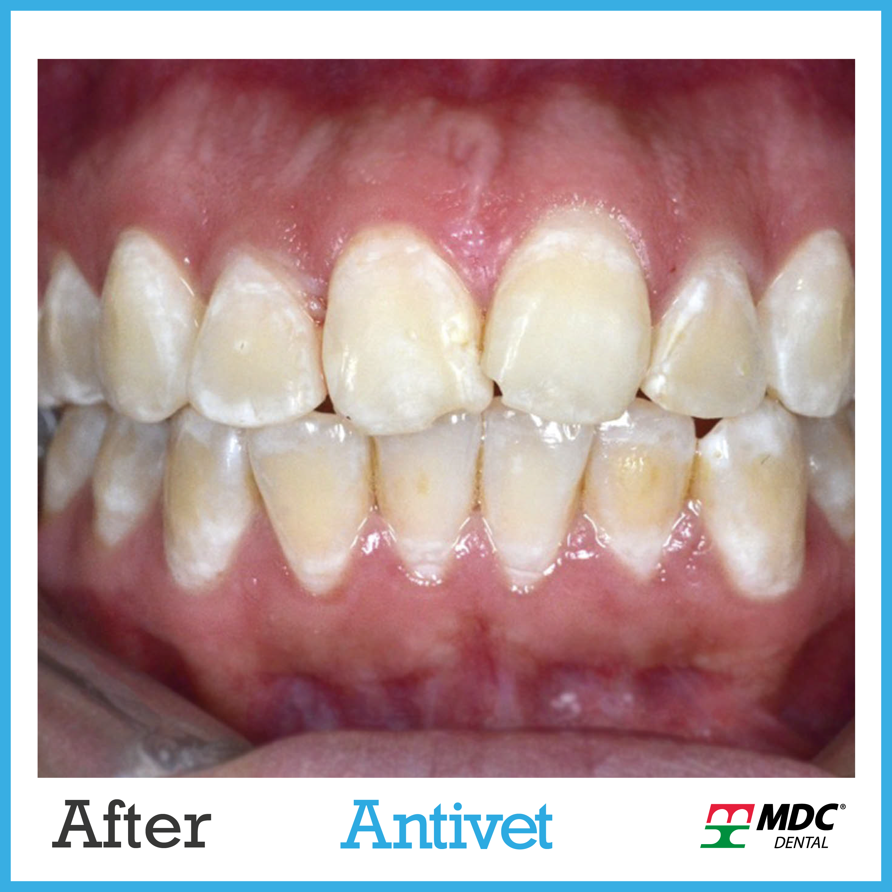 Antivet | Case Studies