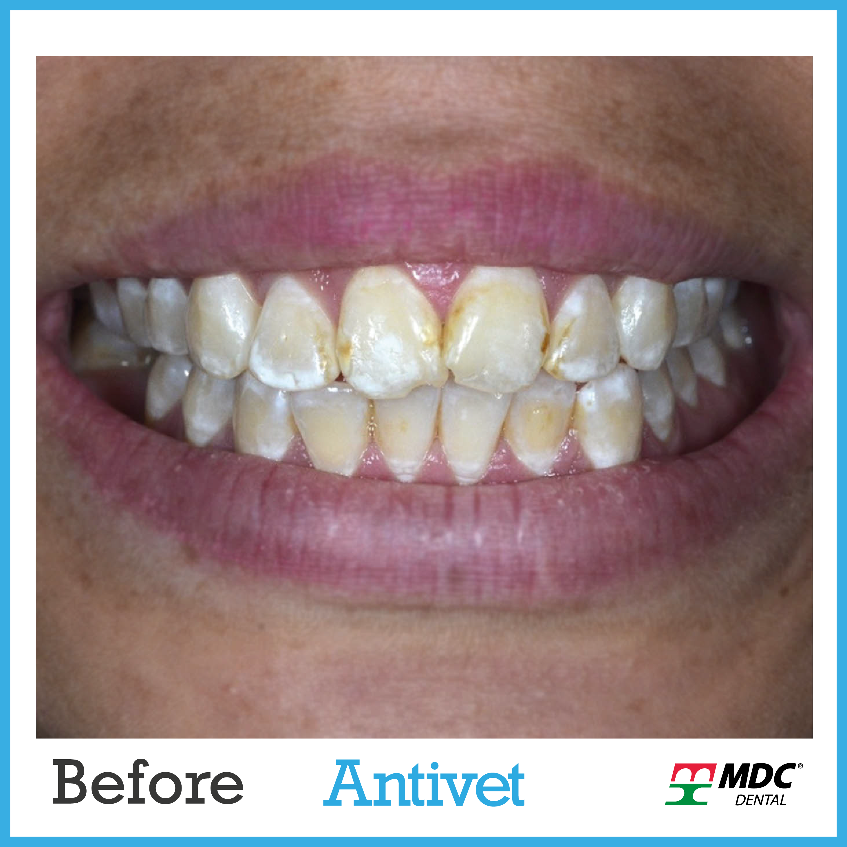 Antivet | Case Studies