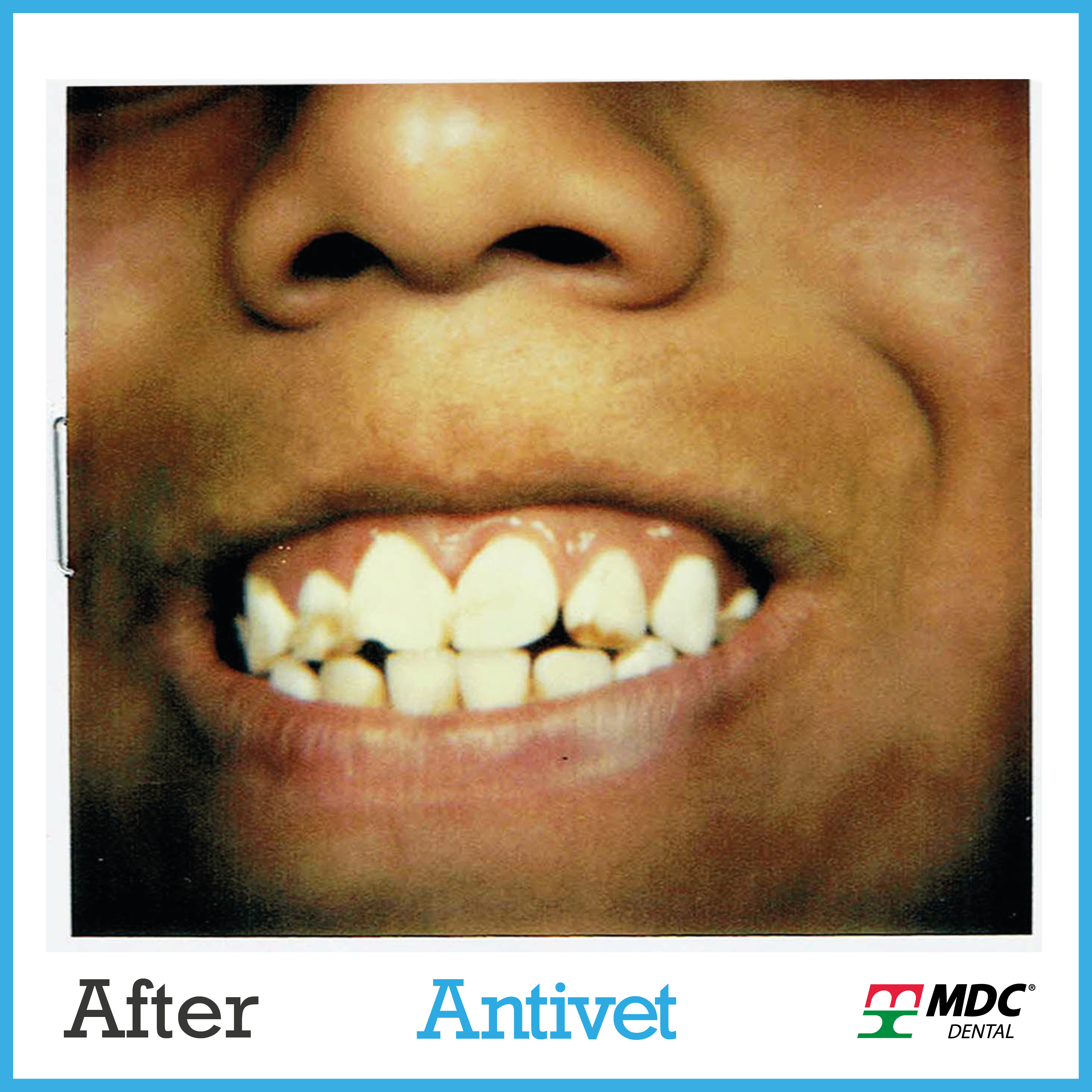 Antivet | Case Studies