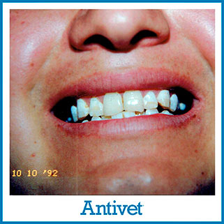 Antivet | Case Studies