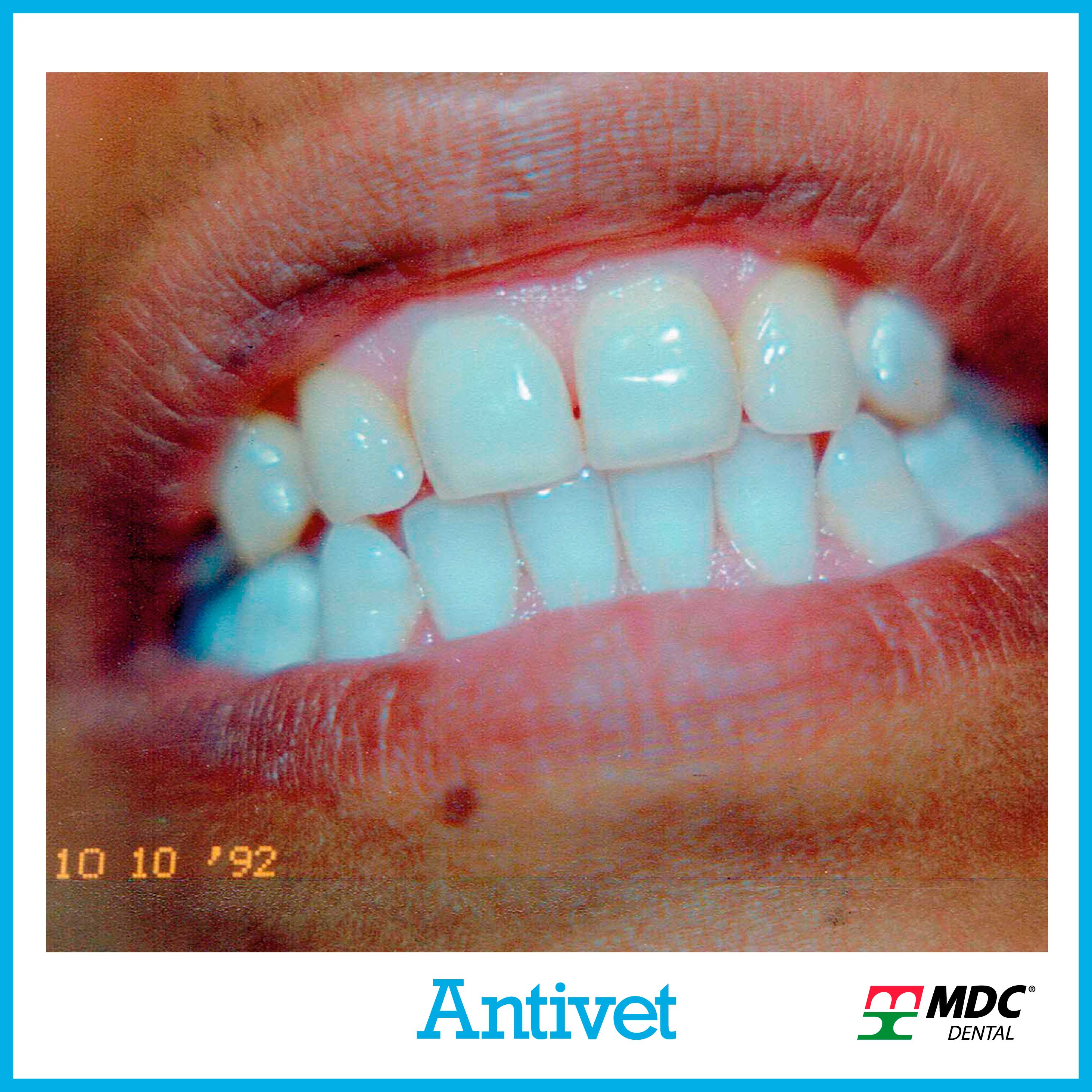 Antivet | Case Studies