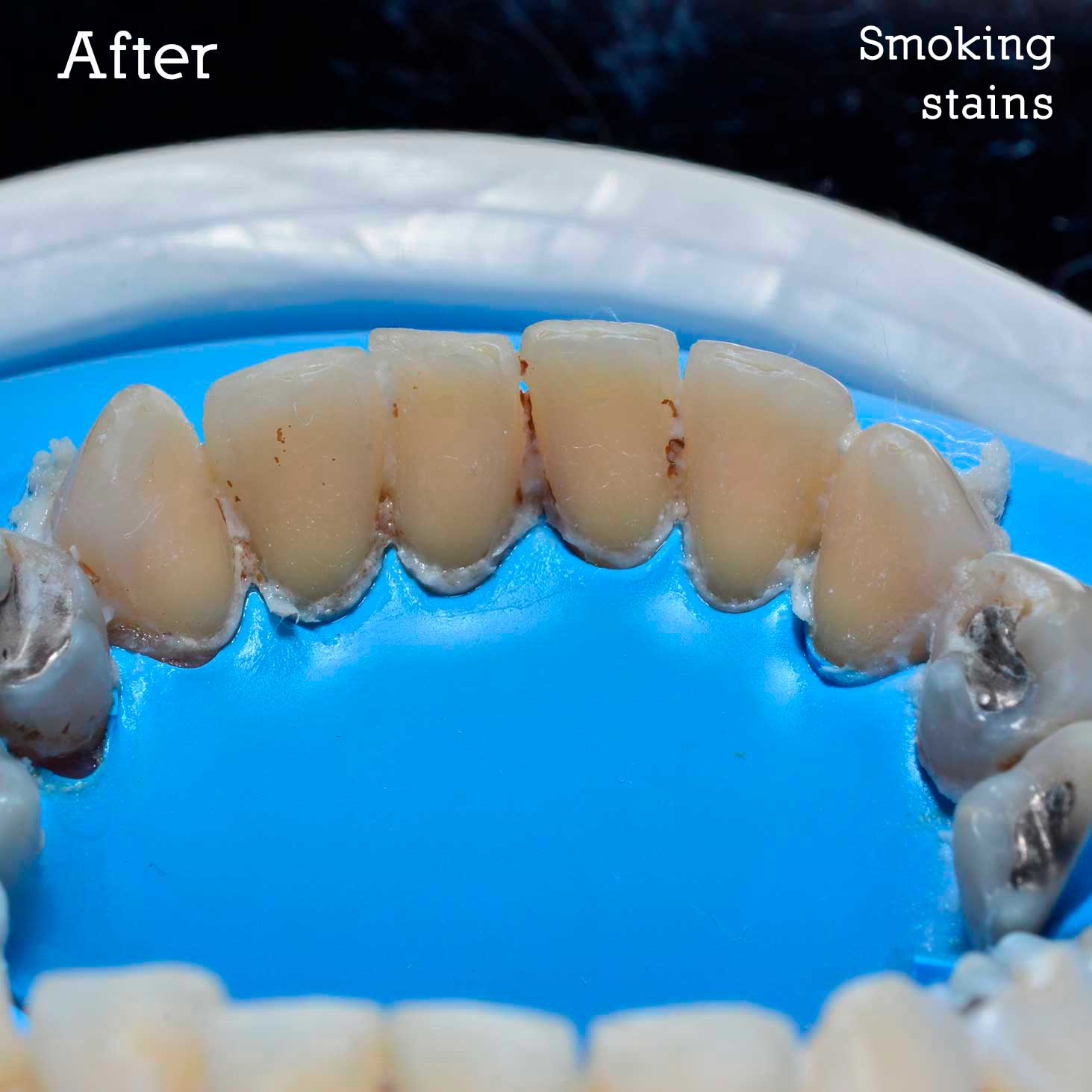 Antivet | Case Studies